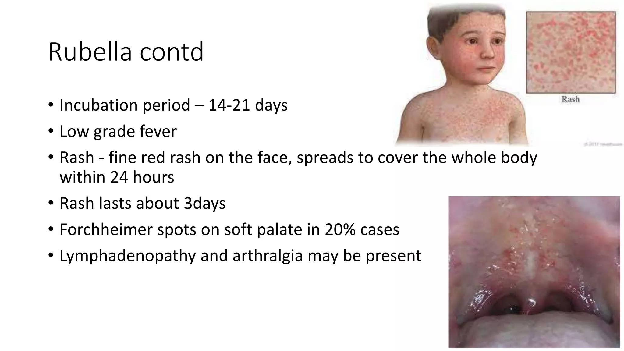Common Viral Infections in children.pptx