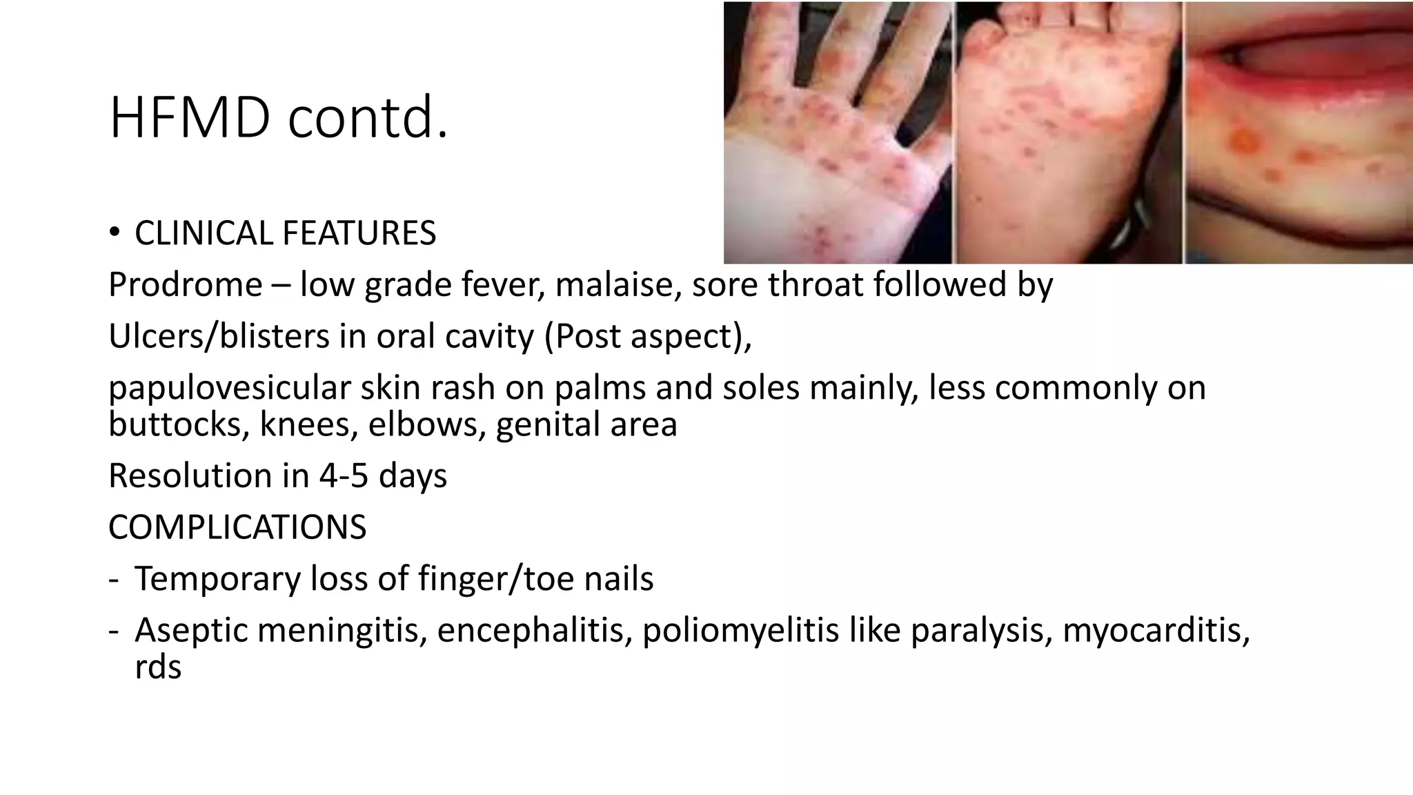 Common Viral Infections in children.pptx