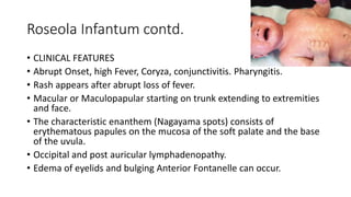 Common Viral Infections in children.pptx