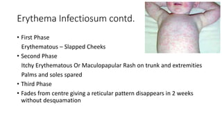 Common Viral Infections in children.pptx