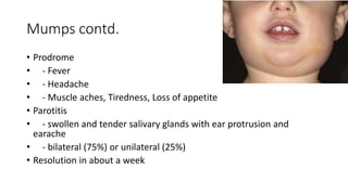 Common Viral Infections in children.pptx