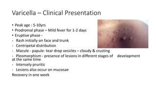 Common Viral Infections in children.pptx