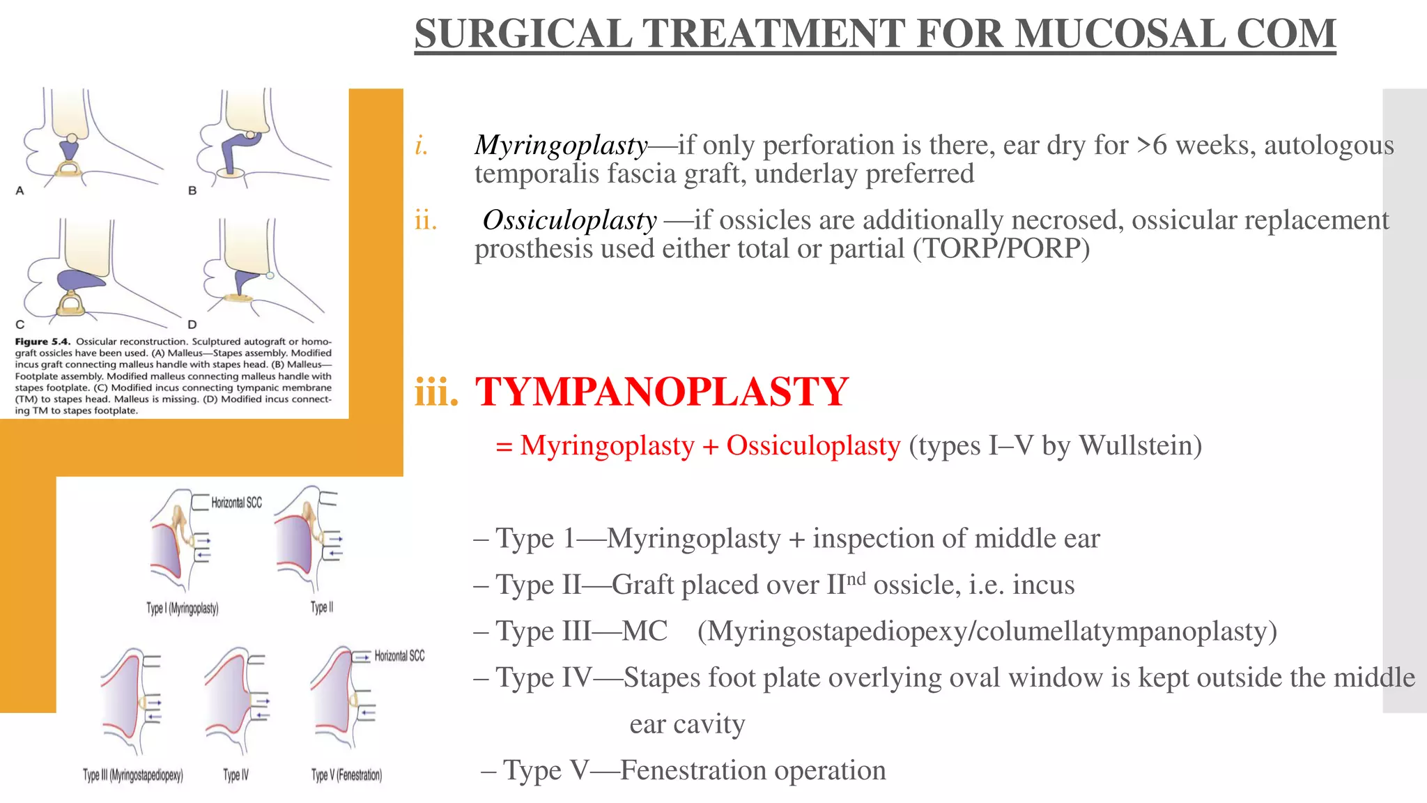 Chronic Otitis Media- mucosal type( UG) .pdf