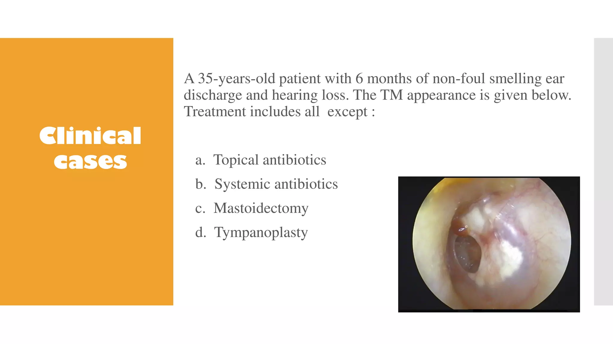 Chronic Otitis Media- mucosal type( UG) .pdf