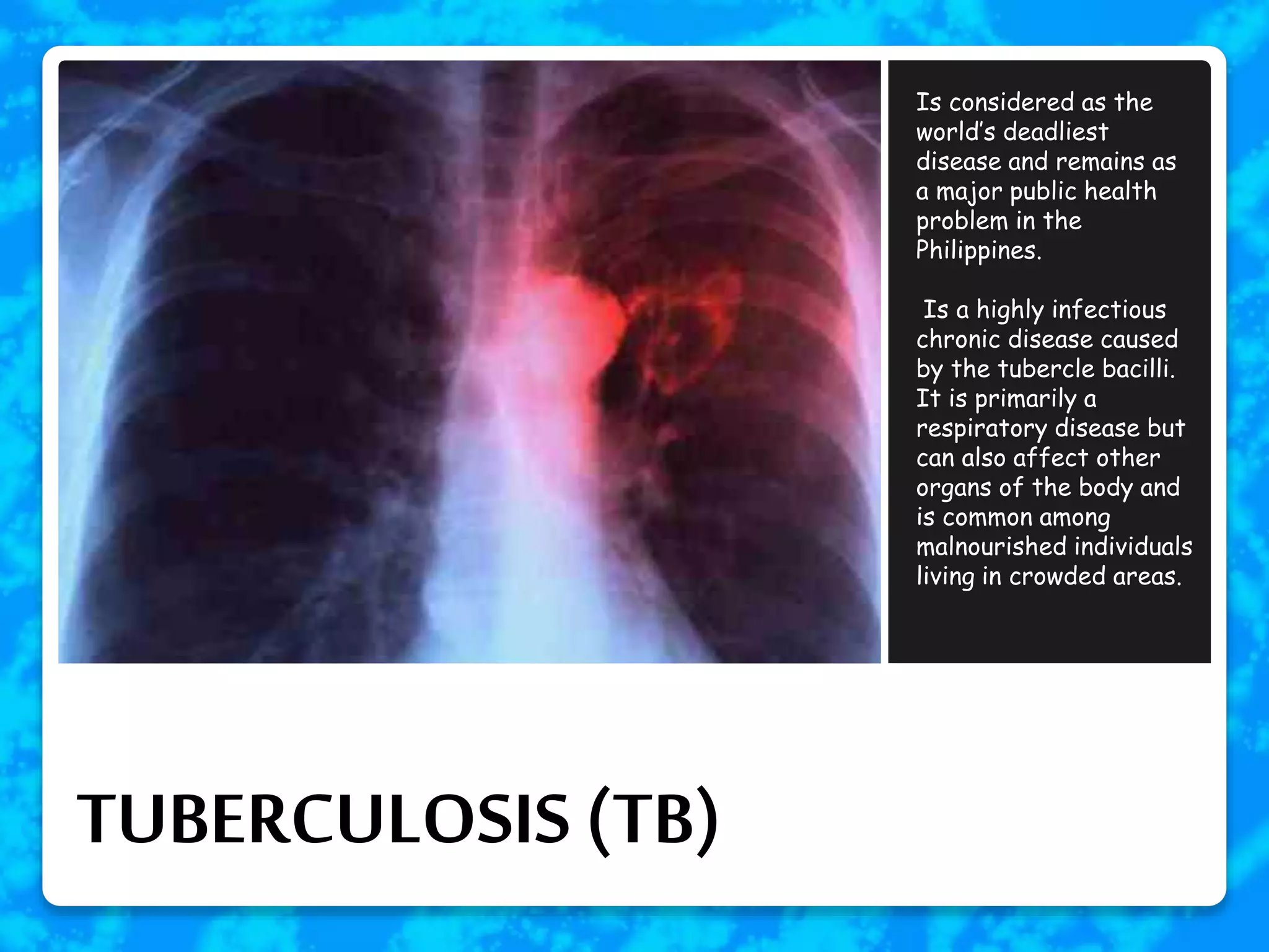 Communicable Diseases | PPTX | Infectious Diseases | Diseases and Conditions