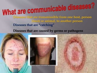 COMMUNICABLE DISEASE AND PATHOGENS2 (1).pptx