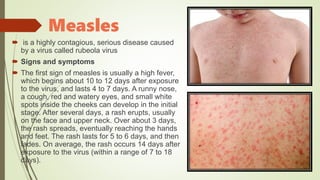 Communicable diseases | PPTX