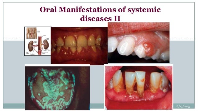 ORAL MANIFESTATION OF SYSTEMIC DISEASE......