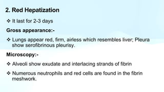 Community Acquired Pneumonia Pathophysiology | PPTX