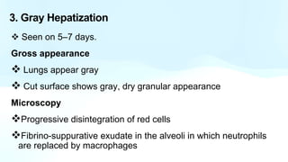 Community Acquired Pneumonia Pathophysiology | PPTX