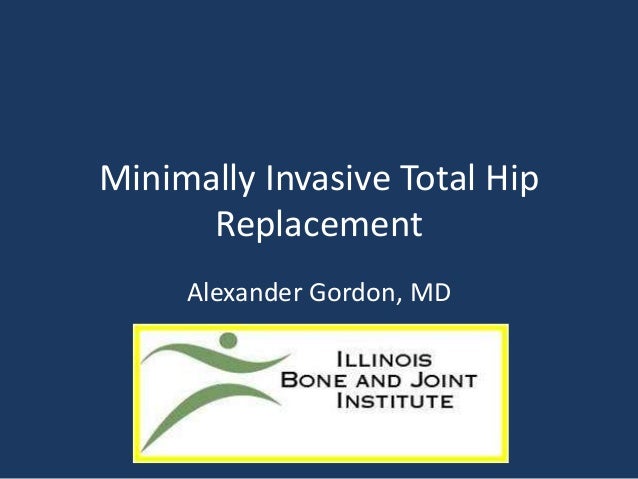 Community Minimally Invasive Total Hip Replacement Slideshow