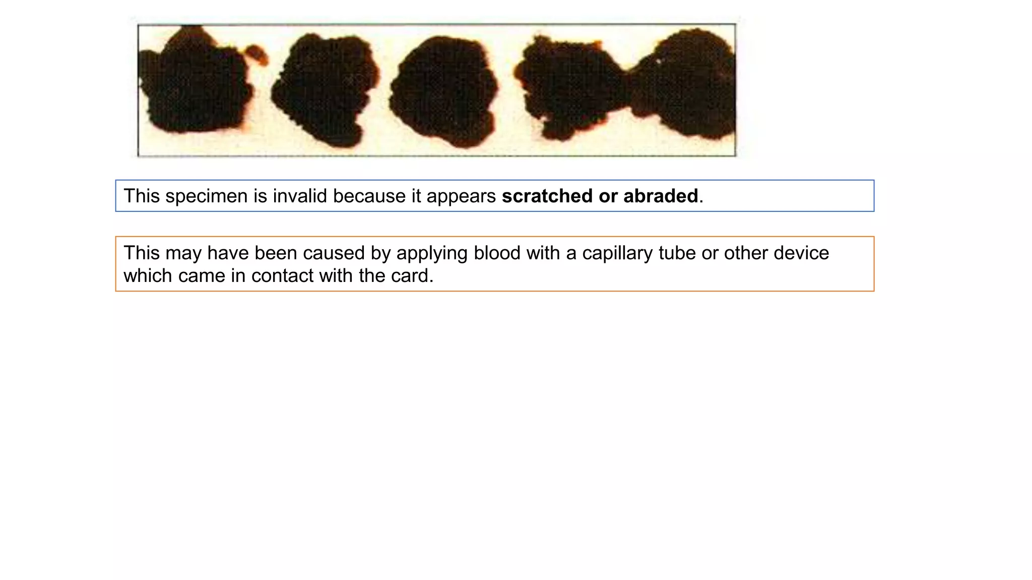 Community Viral Load Sample Collection_V2_Team Review_Feb10-22.pptx