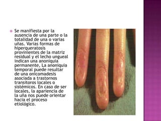 Como cuidar las uñas | PPT | Descarga Gratuita