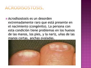 Como cuidar las uñas | PPT | Descarga Gratuita