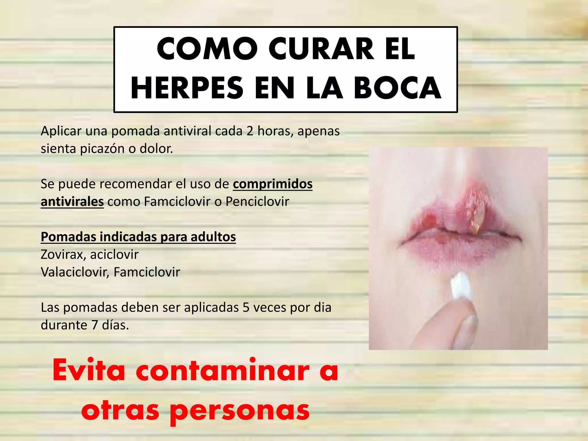 Como Curar El Herpes Labial Pptx