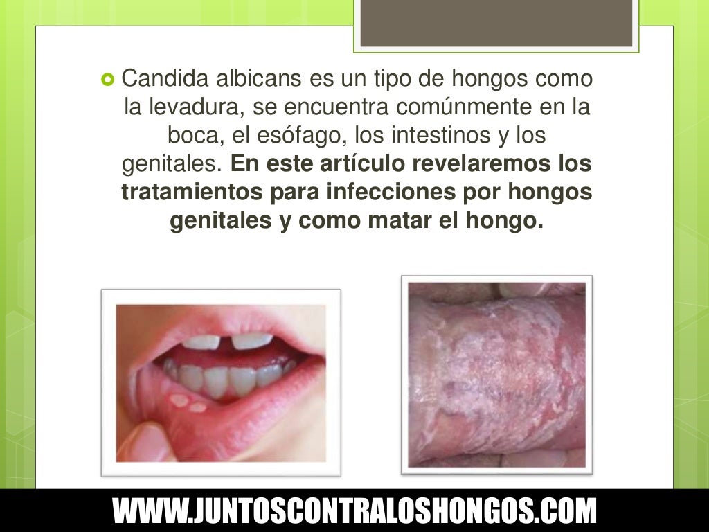 Como Eliminar los Hongos Genitales por Candida Albicans Tratamiento N…
