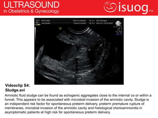 Como medir la longitud cervical.ppt