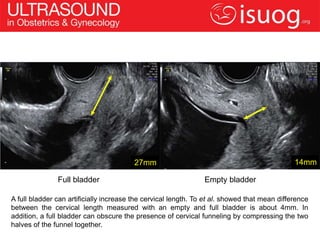 Como medir la longitud cervical.ppt