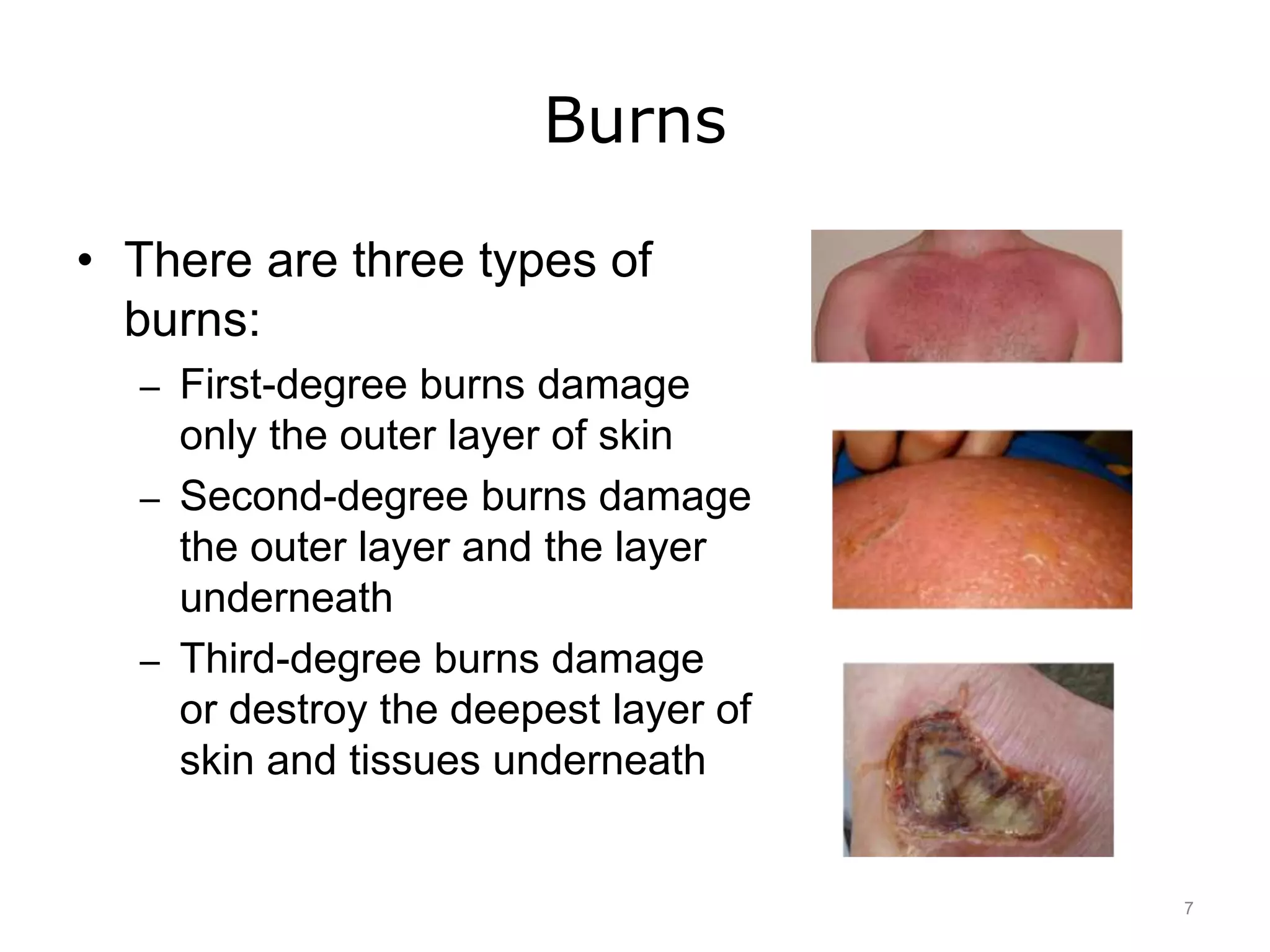 Integumentary System -Lecture A slides | PPTX