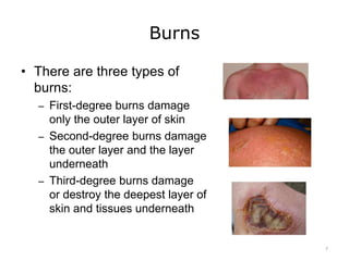 Integumentary System -Lecture A slides | PPT