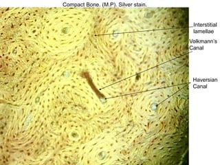 Compact Bone Under Microscope