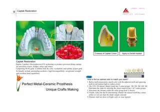 China dental lab | PPT