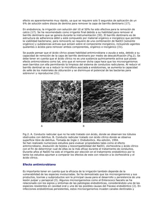Comparacion de tres soluciones irrigantes utilizadas en endodoncia | DOCX