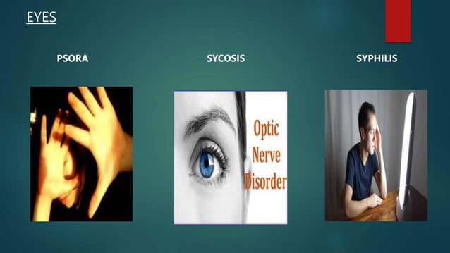 comparative study of 3 basic miasm.pptx