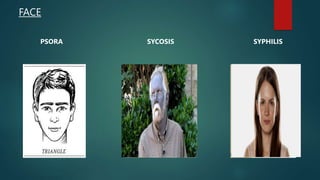 comparative study of 3 basic miasm.pptx