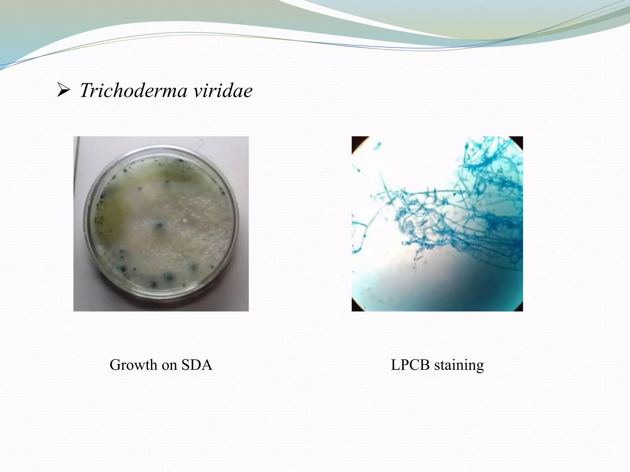 Comparative study of cellulase production by aspergillus niger and trichoderma viridae using ...