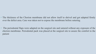Comparative study of DFDBA and FDBA block grafts.pptx | Bone and Joint ...