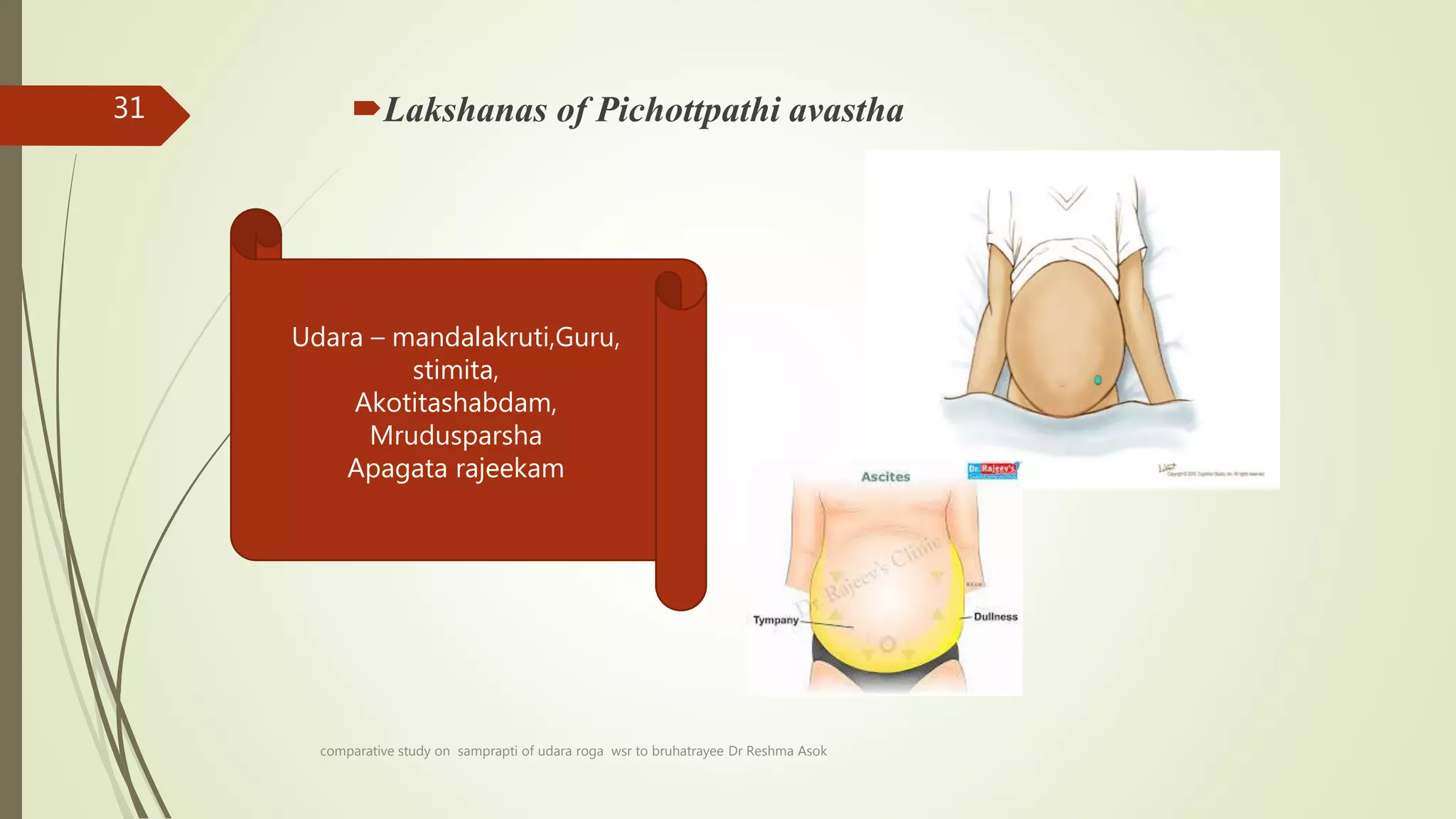 Comparative study of udara samprapti | PPTX