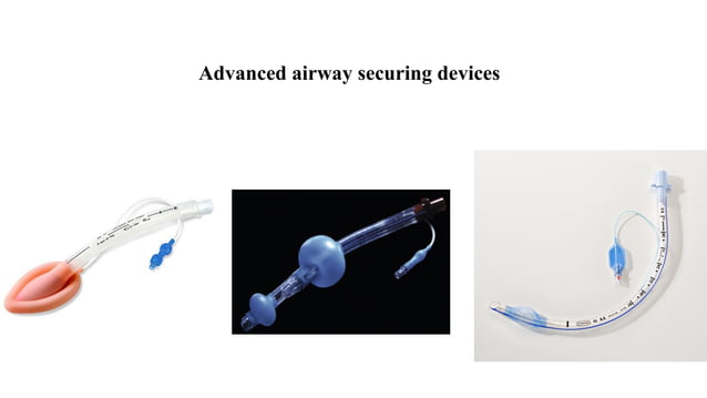 Comparative study of Video laryngoscope vs macintosh laryngoscopy.pptx
