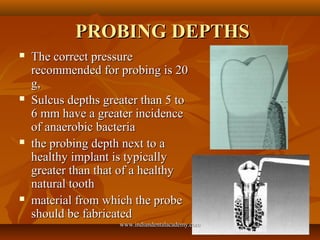 Comparision of tooth and implant/endodontic courses | PPT