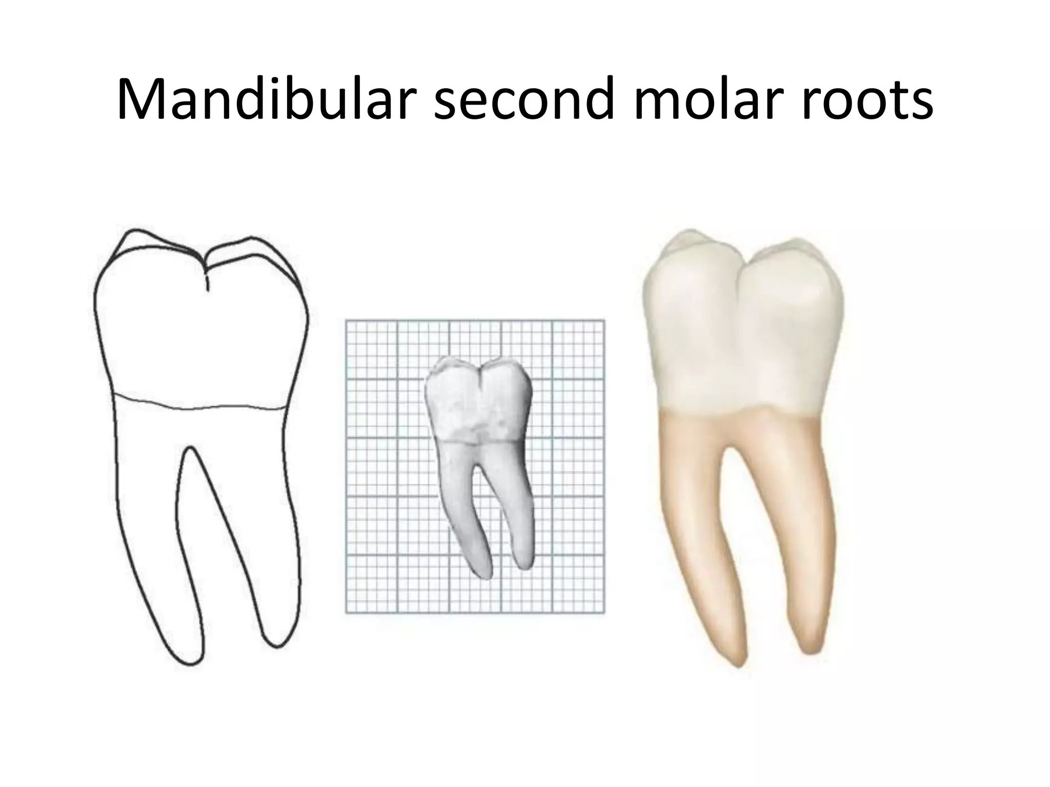 mandibular second molars | PPTX