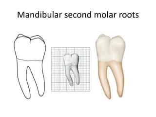 mandibular second molars | PPTX