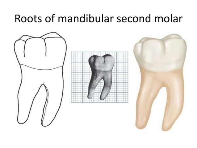 mandibular second molars | PPTX