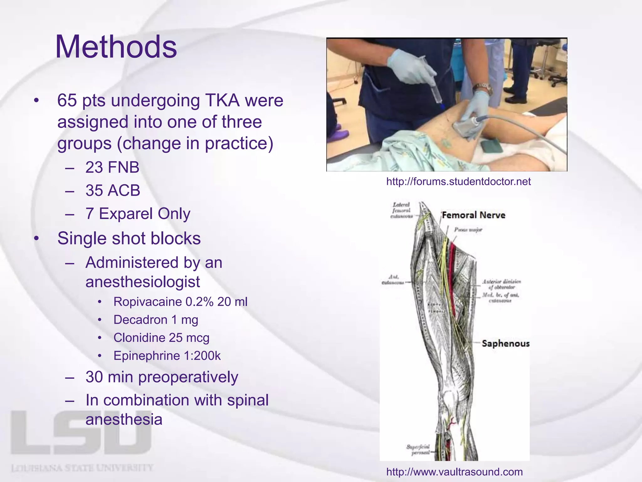 Comparison of Adductor Canal and Femoral Nerve Blocks in Primary TKA 06 ...