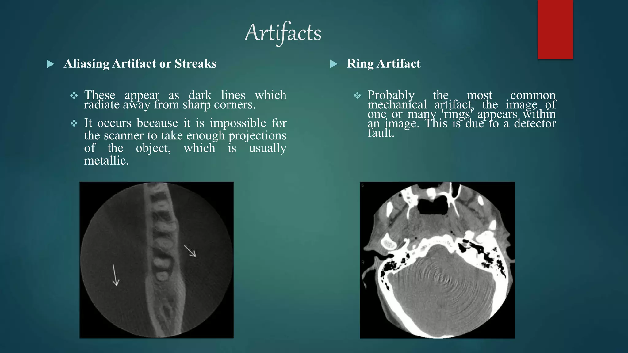 Comparison of ct and cbct | PPTX