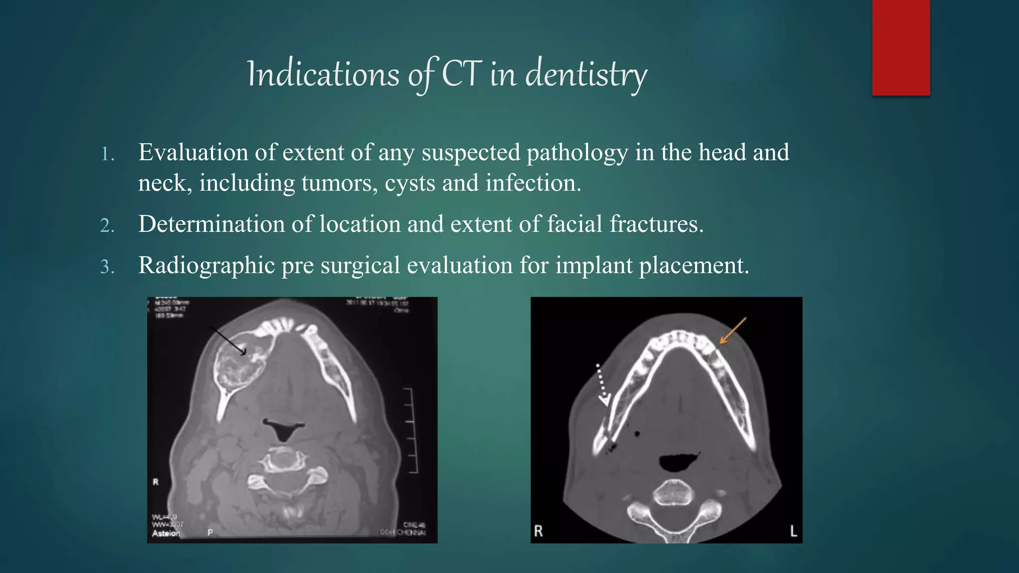 Comparison of ct and cbct | PPTX