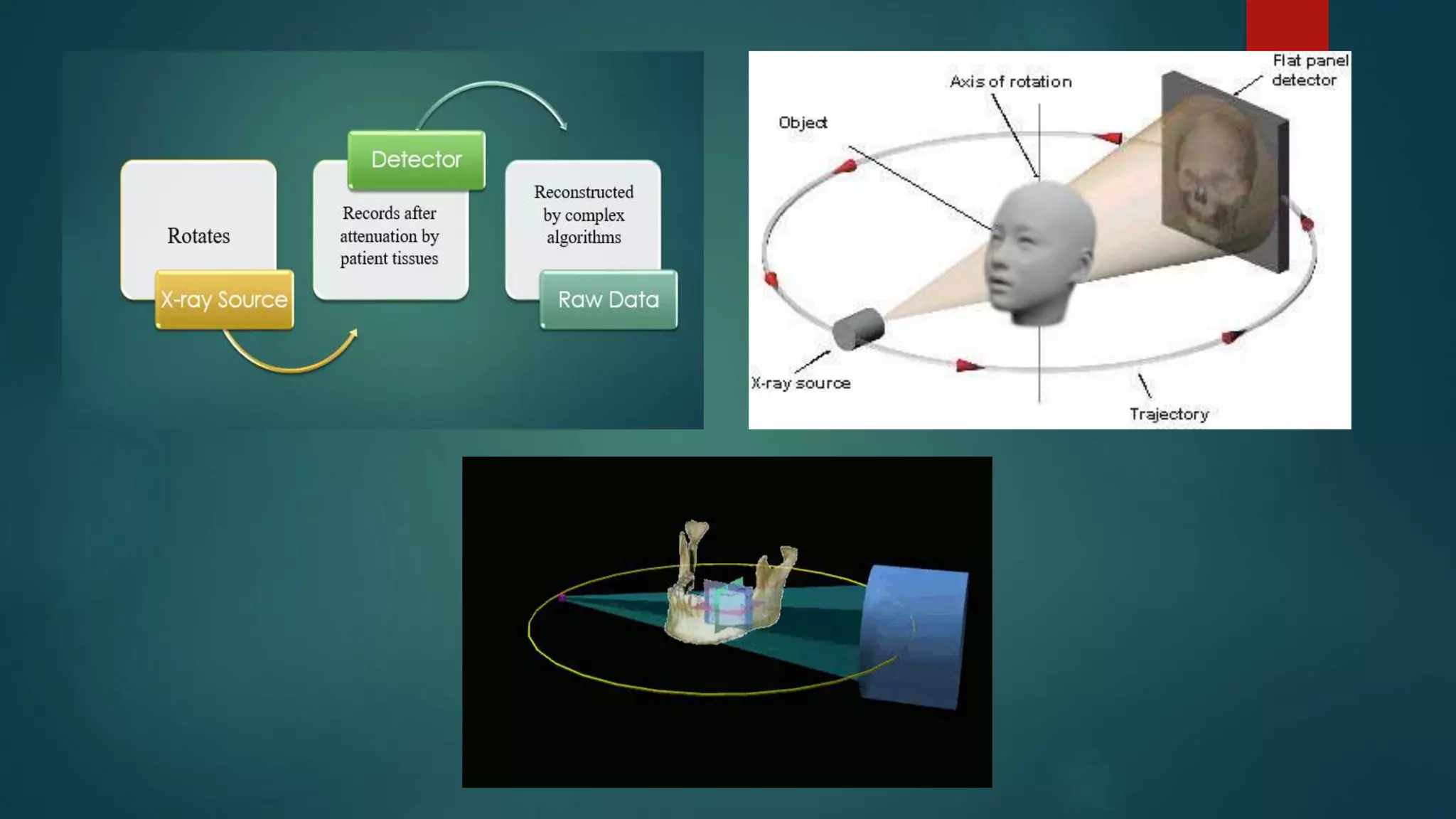Comparison of ct and cbct | PPTX