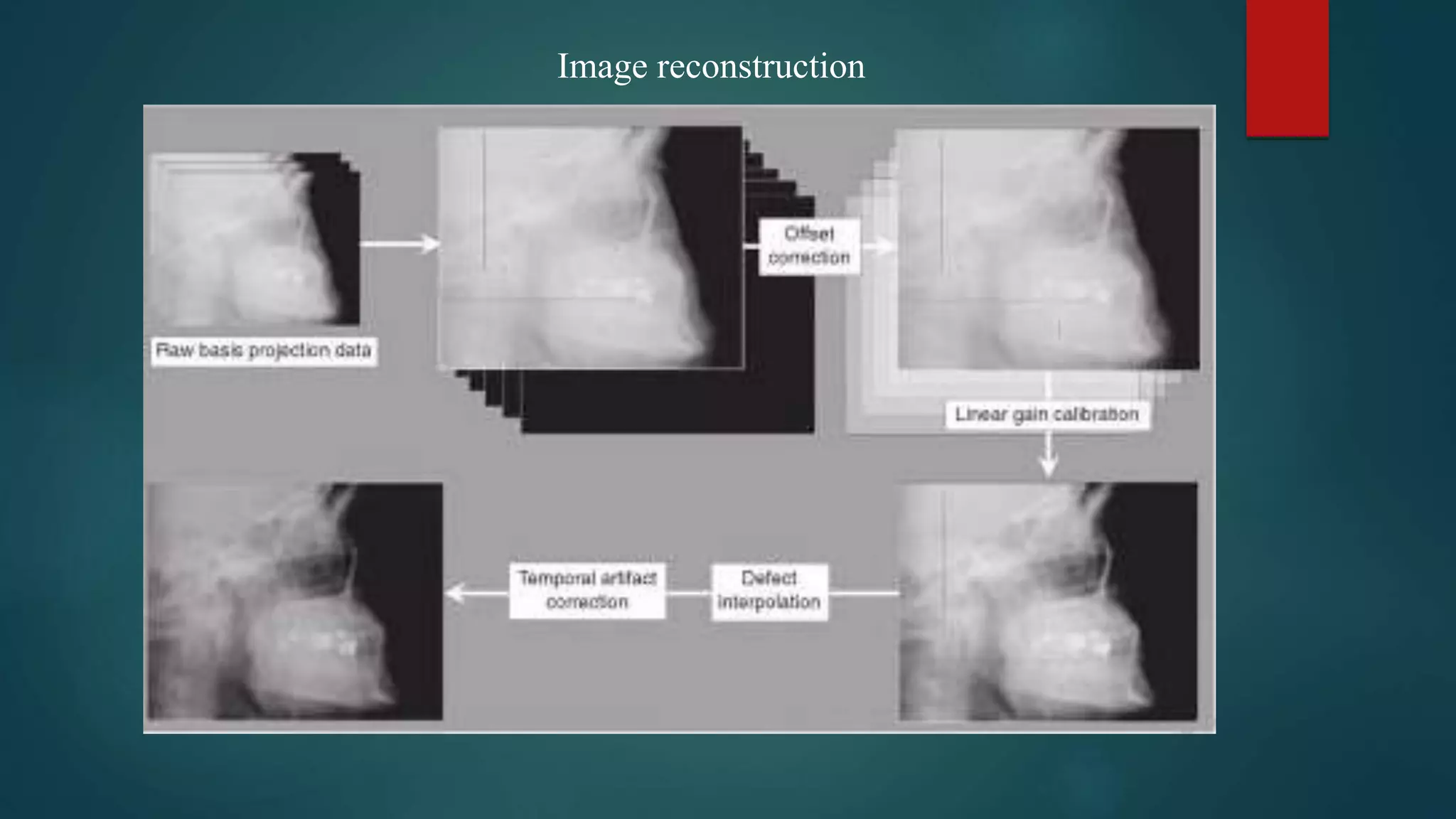Comparison of ct and cbct | PPTX