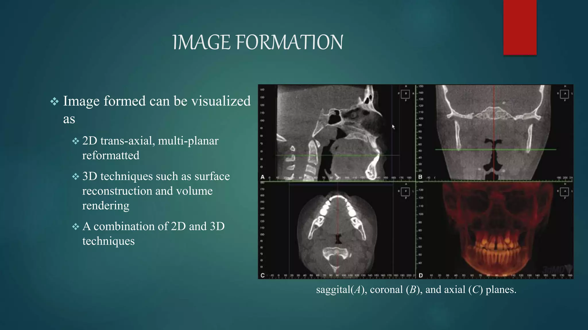 Comparison of ct and cbct | PPTX