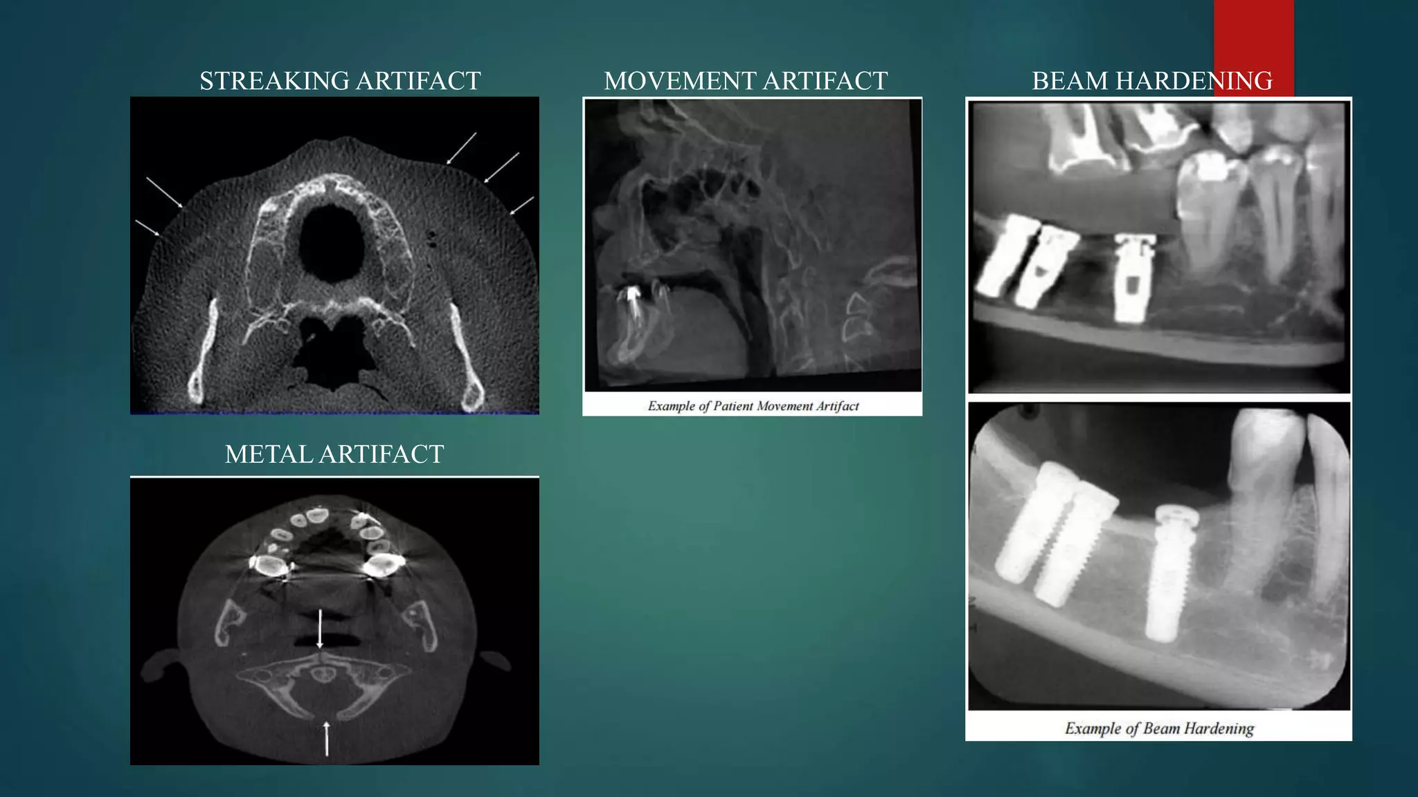 Comparison of ct and cbct | PPTX