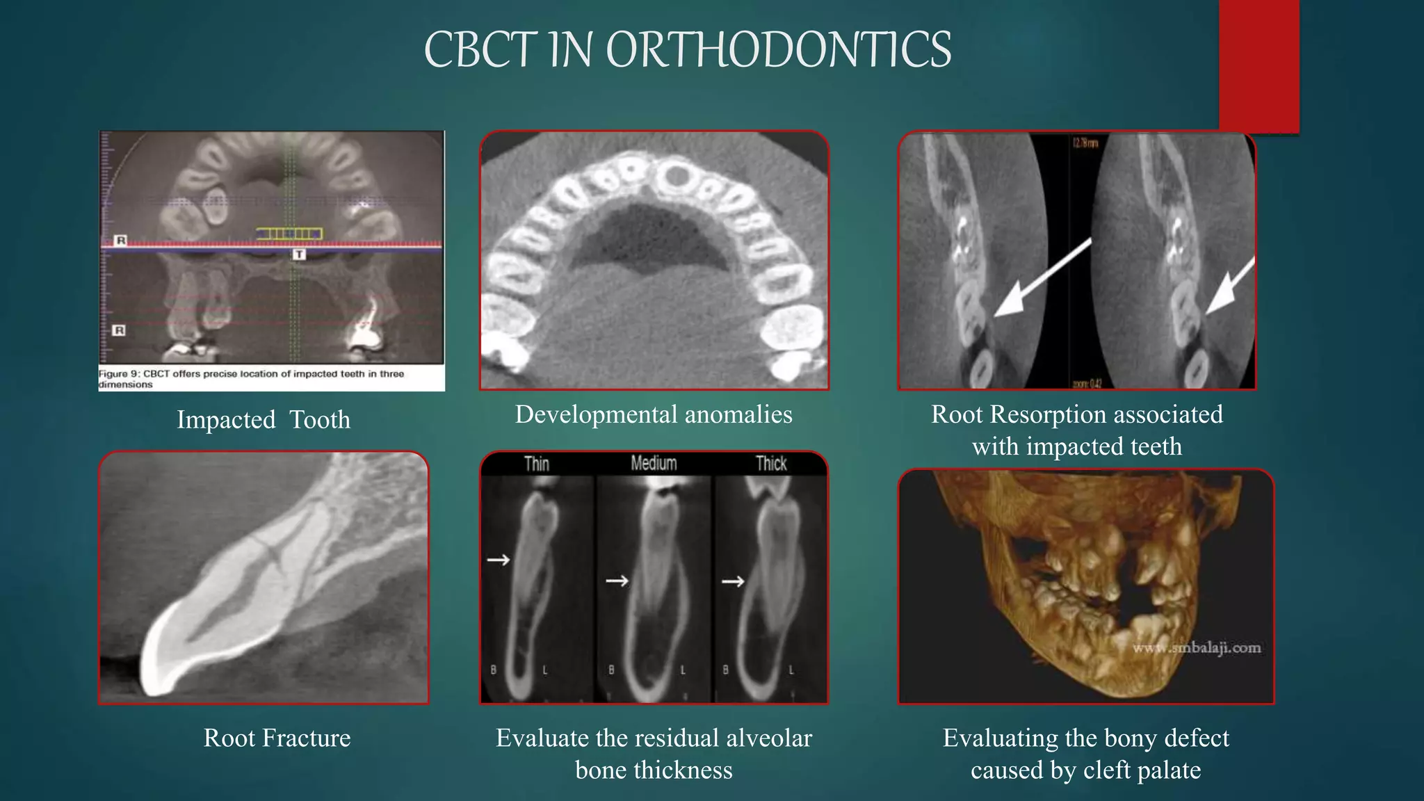 Comparison of ct and cbct | PPTX