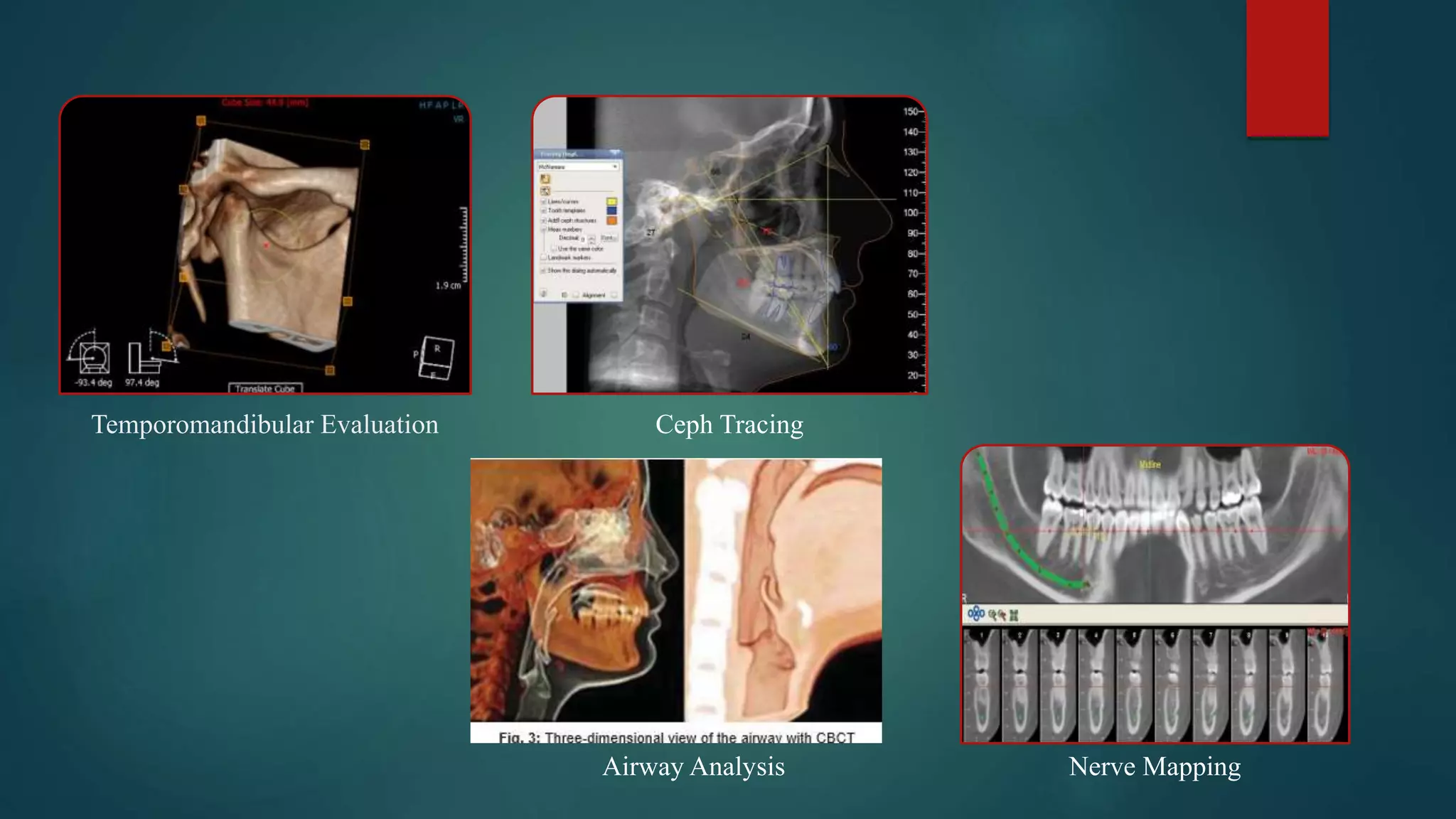 Comparison of ct and cbct | PPTX