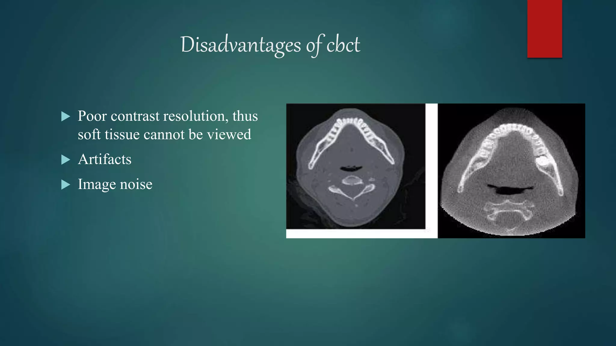 Comparison of ct and cbct | PPTX