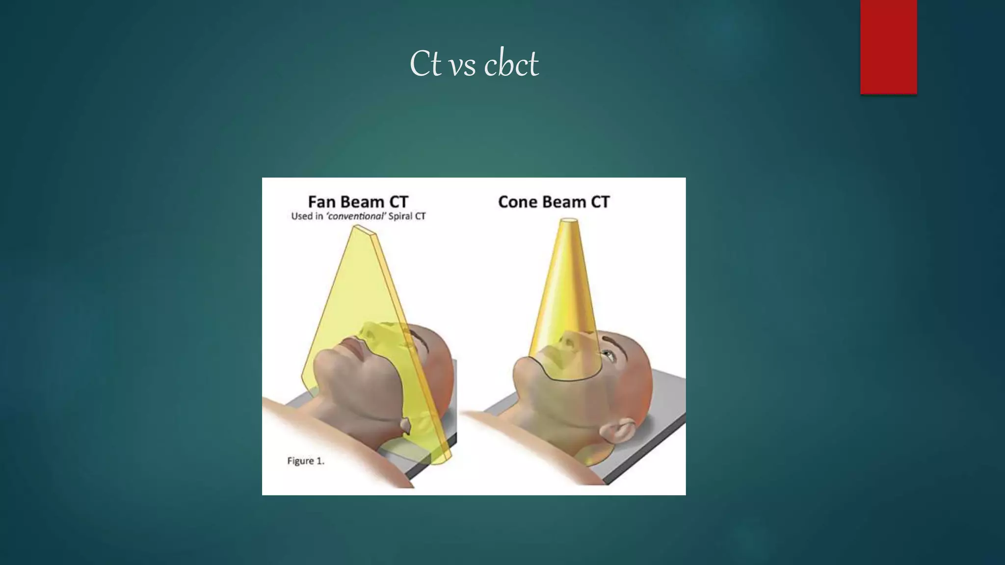 Comparison of ct and cbct | PPTX