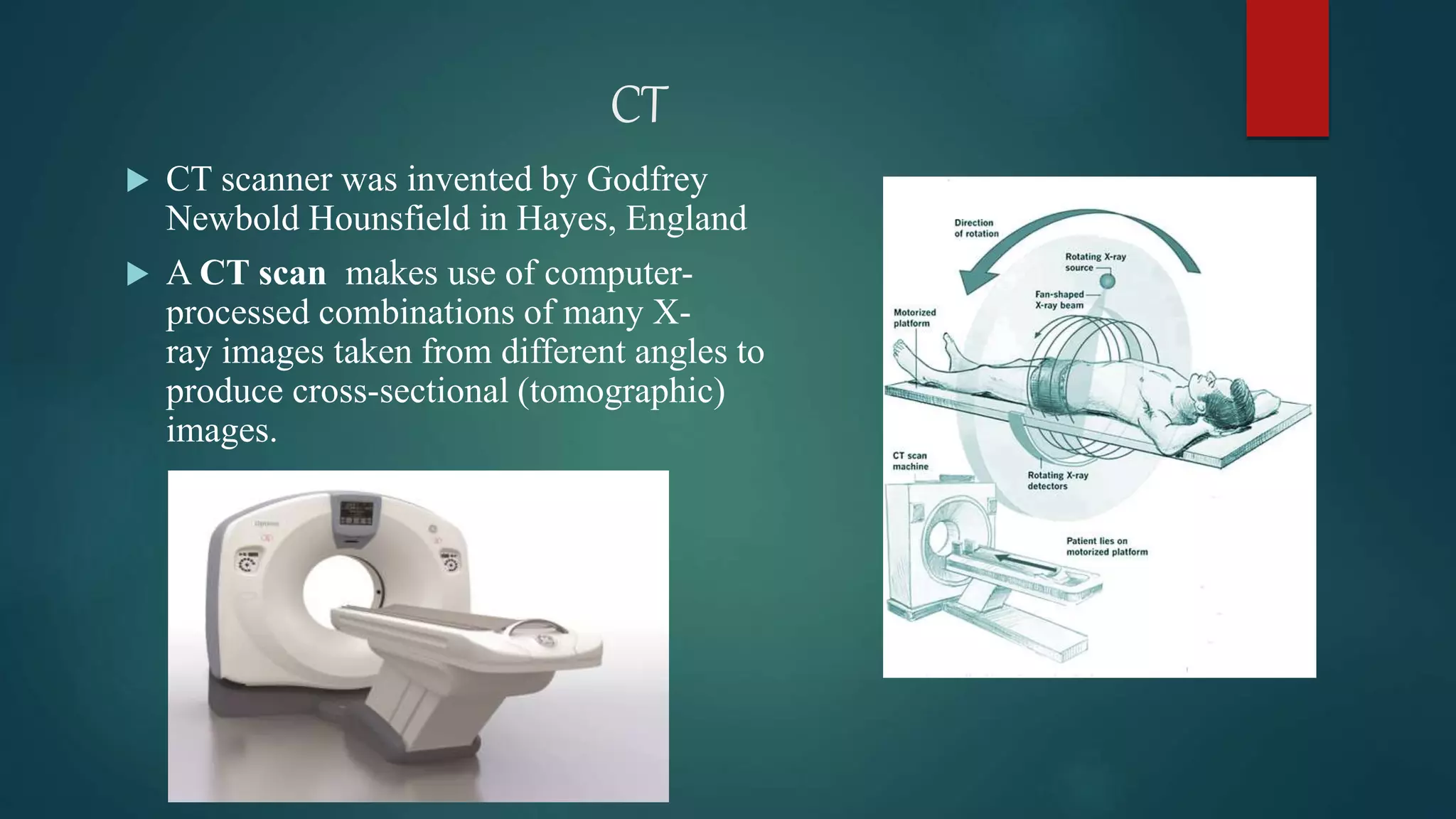 Comparison of ct and cbct | PPTX
