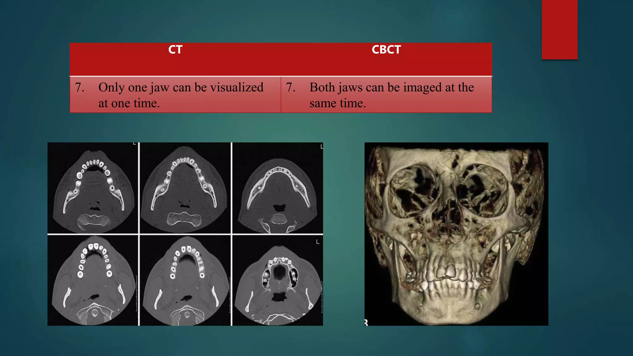 Comparison of ct and cbct | PPTX